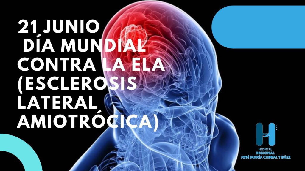 Esclerosis lateral amiotrófica (ELA) - Hospital Cabral y Baez
